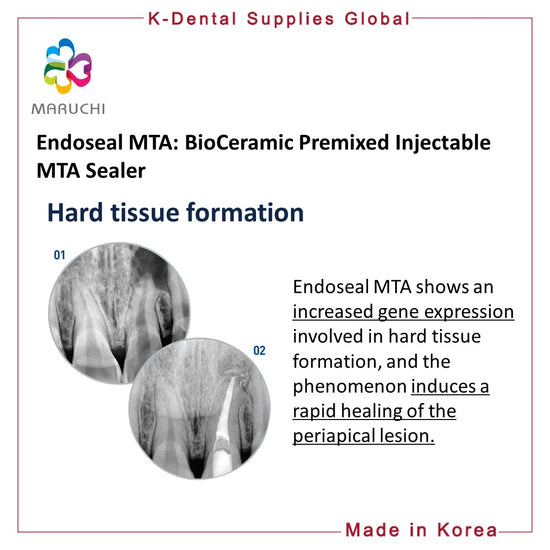 Endoseal MTA bioceramic sealer – K-Dental Supplies Global